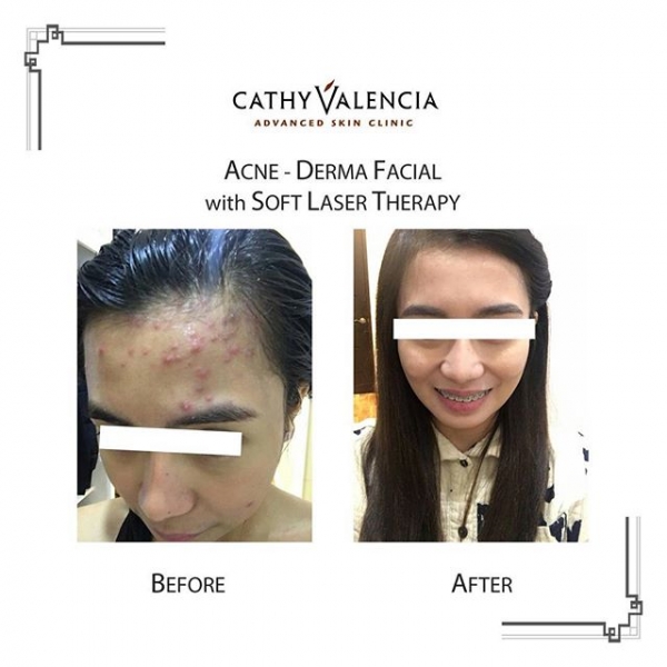 CV FACIAL – Cathy Valencia