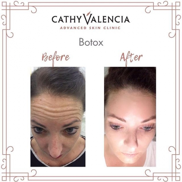 CV FACE CONTOURING ANTI-AGING TREATMENT – Cathy Valencia