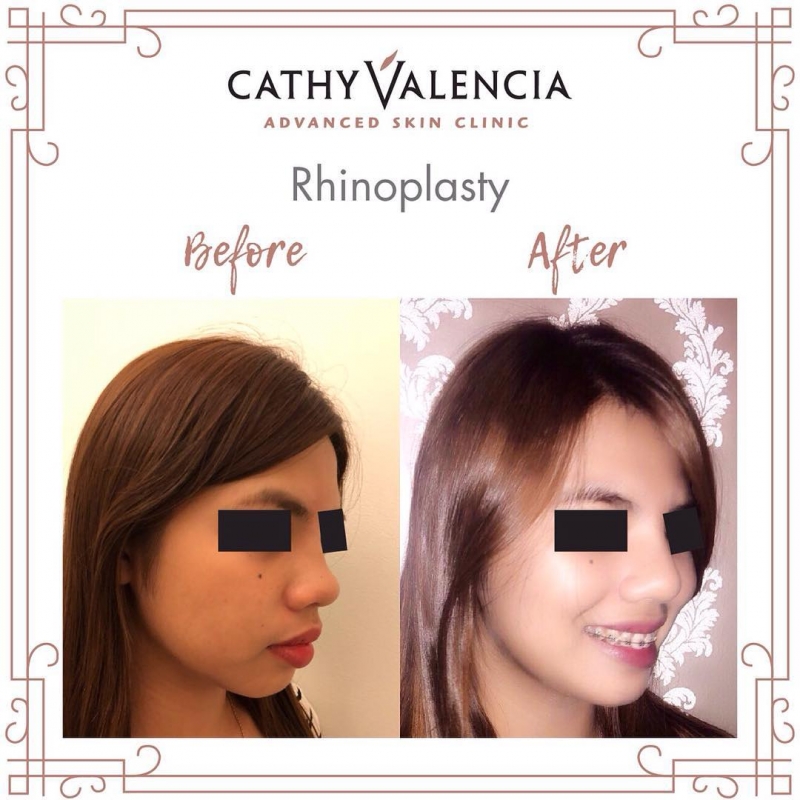 SURGICAL PROCEDURE AND OTHER SERVICES – Cathy Valencia